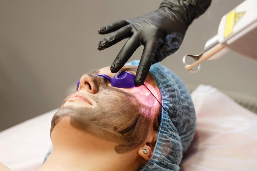 How to Achieve Smooth Skin with Carbon Laser Therapy? | Healthy Talkie